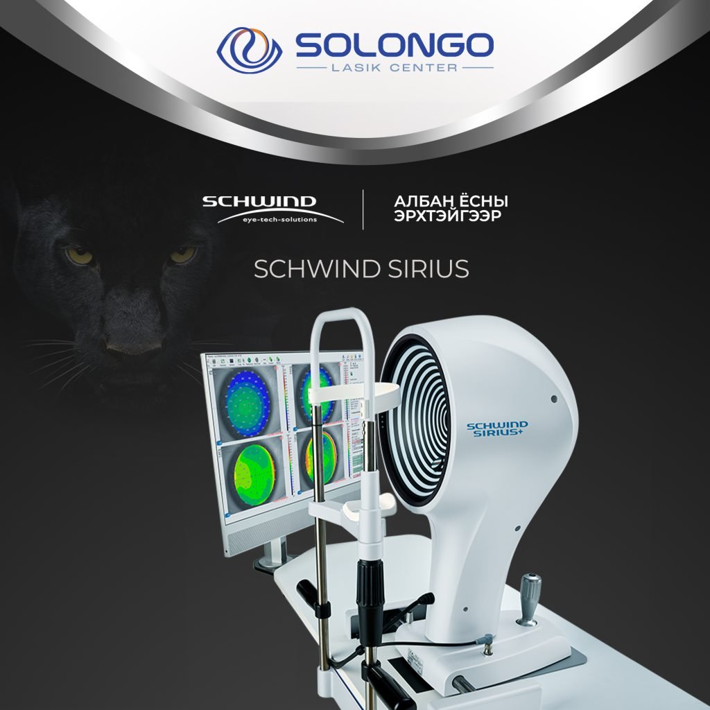SCHWIND SIRIUS+ - Solongo Lasik Center